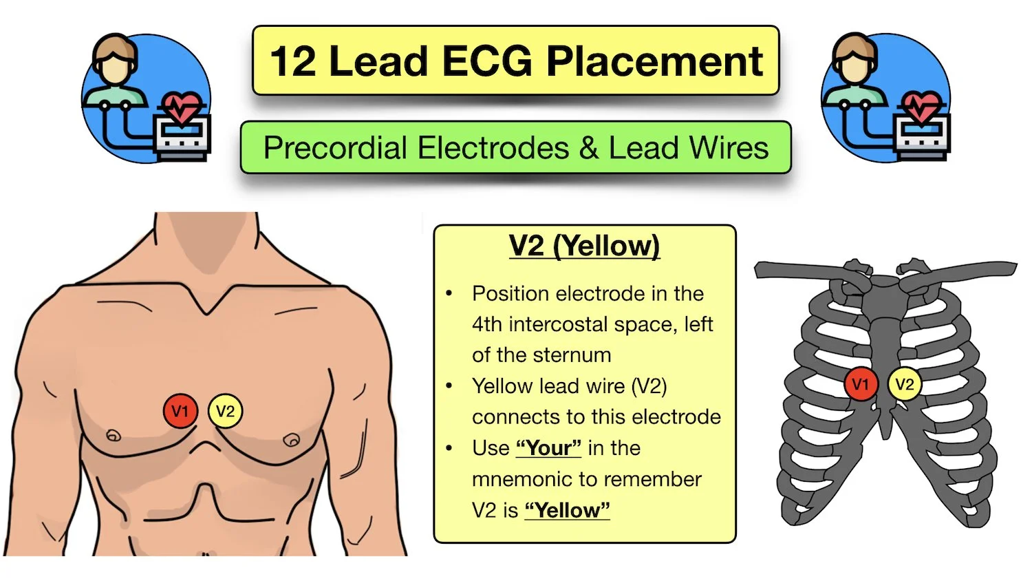 12 Lead ECG Placement: Diagram and Mnemonic for Limb and Precordial ...