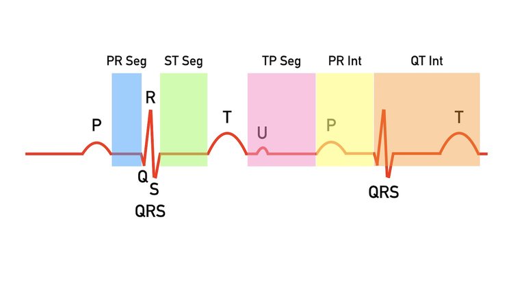 ECG Waveform Explained: EKG Labeled Diagrams and Components — Simplico