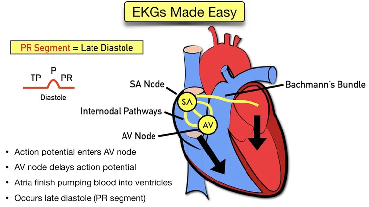 ECG Waveform Explained: EKG Labeled Diagrams and Components — Simplico