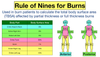 Parkland Formula for Burns: Pediatric and Adult Examples, Calculator ...
