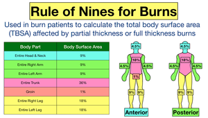 Parkland Formula for Burns: Pediatric and Adult Examples, Calculator ...