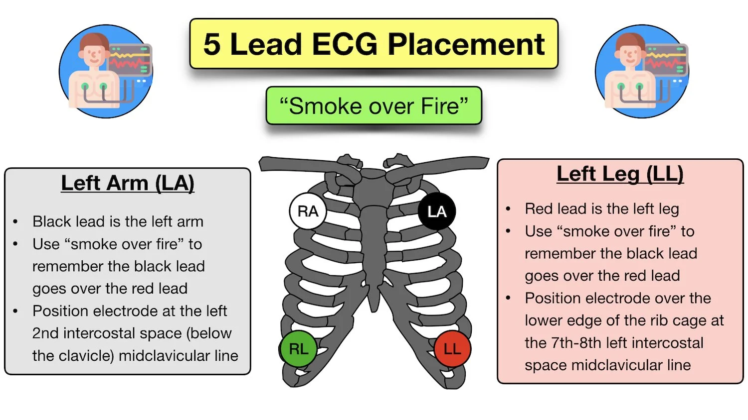 How to Place a 5 Lead ECG: Acronym, Mnemonic, Diagram for Electrode ...