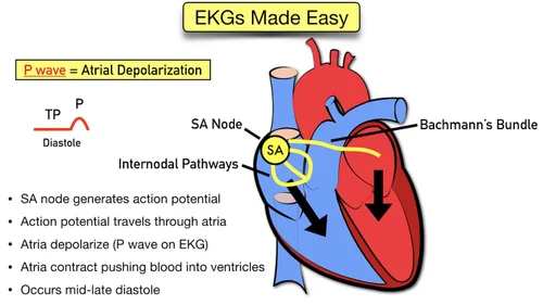 ECG Waveform Explained: EKG Labeled Diagrams and Components — Simplico