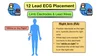 12 Lead ECG Placement: Diagram and Mnemonic for Limb and Precordial ...