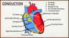 Conduction System of the Heart: Step-By-Step Labeled Diagram and ...