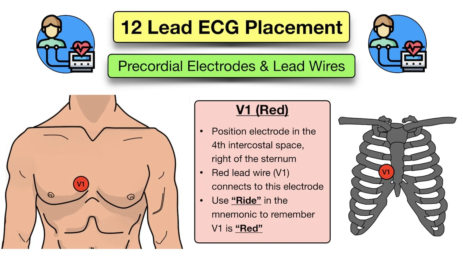 12 Lead ECG Placement: Diagram and Mnemonic for Limb and Precordial ...