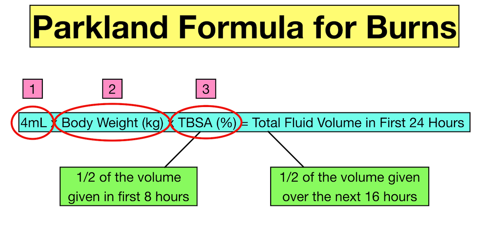 Parkland Formula for Burns: Pediatric and Adult Examples, Calculator ...