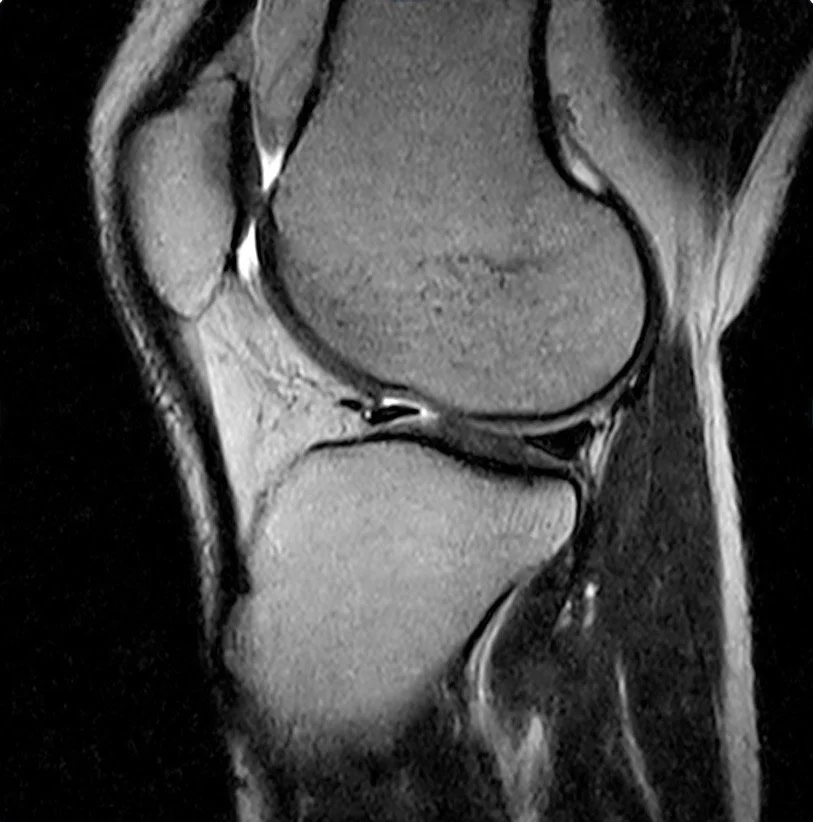 Joint MRI Scans | Imaging Services — InForm Imaging