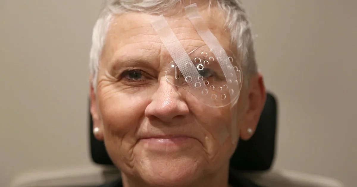 Cataract Surgery Recovery Timeline: Day by Day Guide — The Cataract Clinic