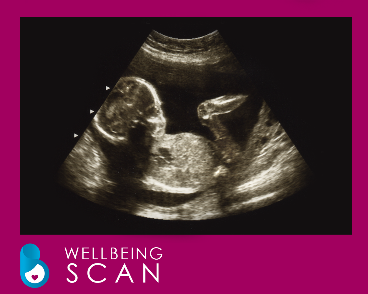 Baby Scan Birmingham - Quality Scans From £39 Only