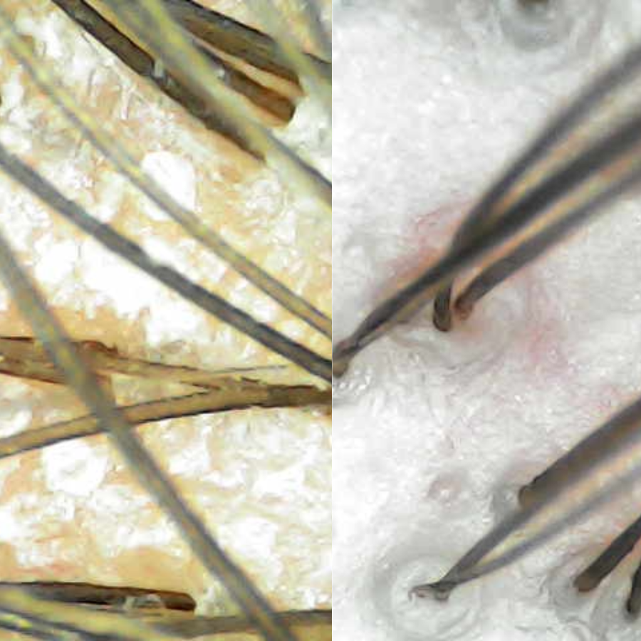 Calm Roots Head Spa & Scalp Clinic