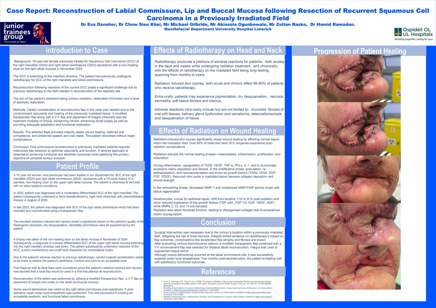 Case Report: Reconstruction of Labial Commissure, Lip and Buccal Mucosa ...