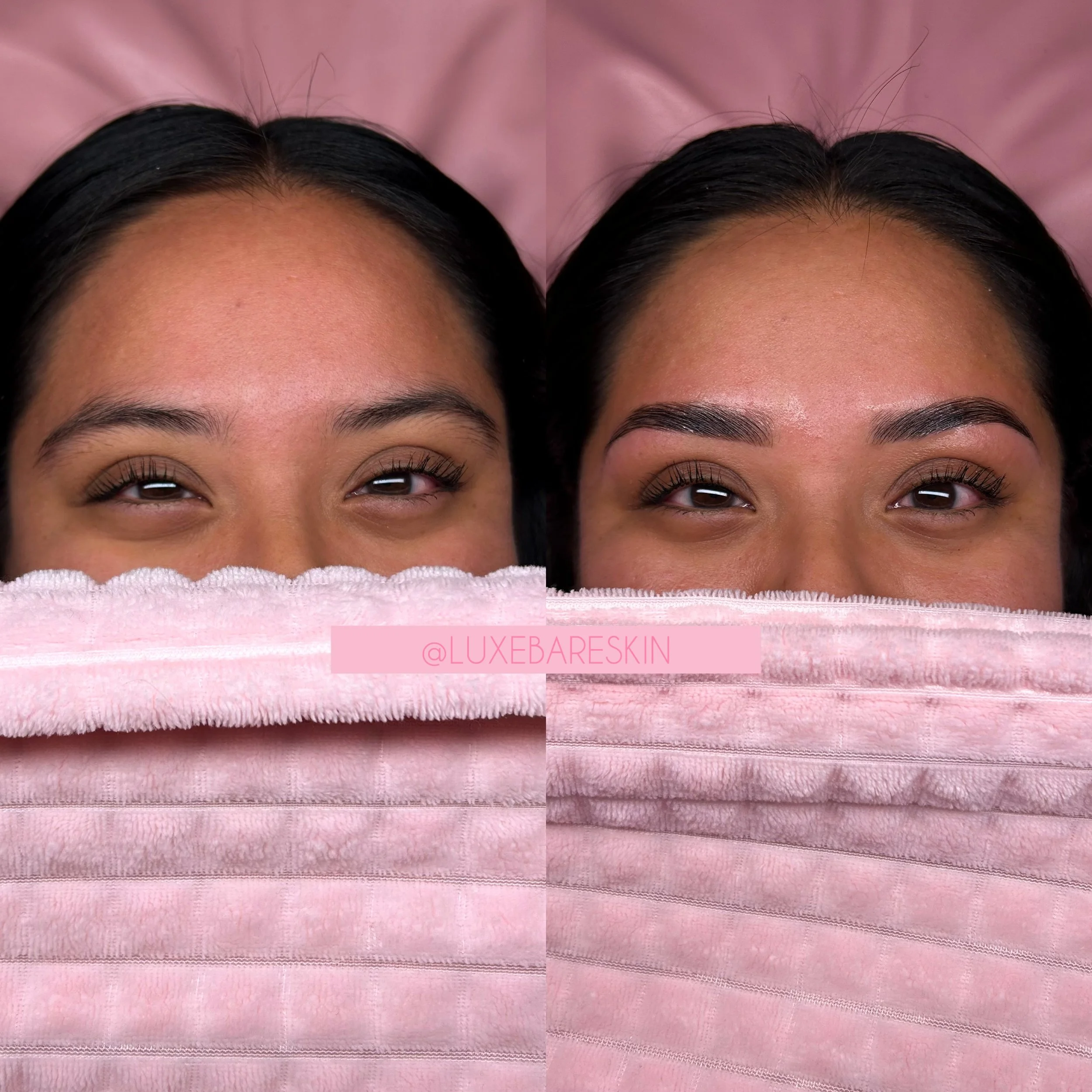 Luxe Bare Skin Esthetics