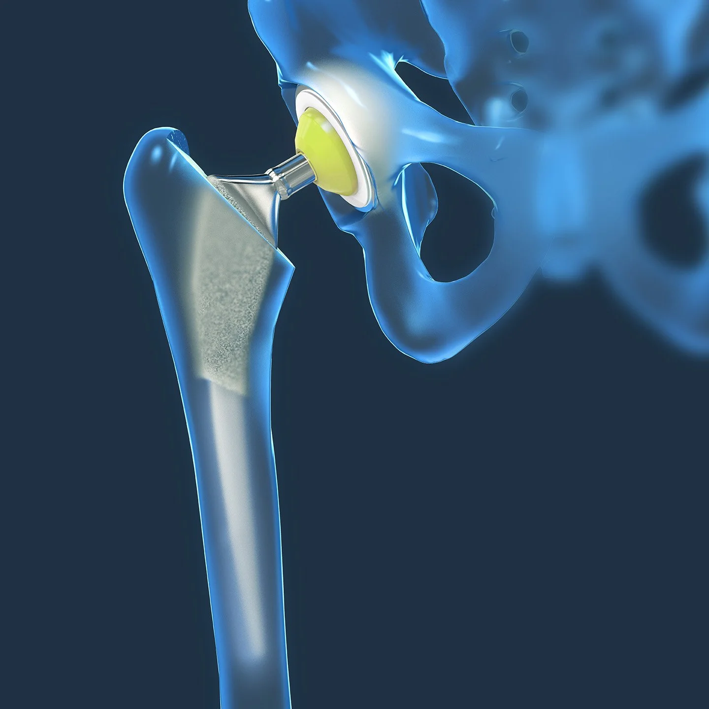 Dr Kade Collins | Melbourne Orthopaedic Surgeon | Hip & Knee Surgery