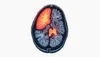 What Does Calcification Mean in an MRI Report? Explained — Read My MRI