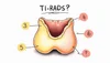 Understanding TI-RADS 3, 4, 5: What Your Score Means and When to Worry ...