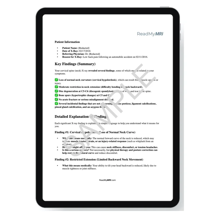 Read My X-Ray - AI Powered CT Report Analysis — Read My MRI