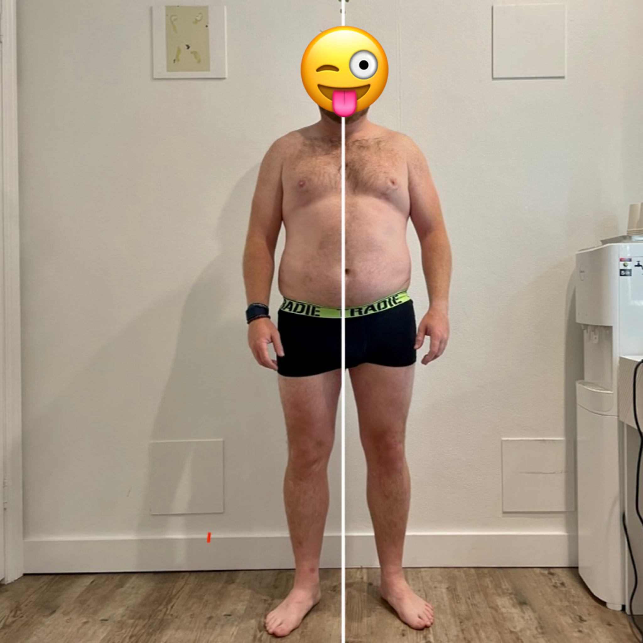 A Guide to Asymmetrical Posture & Movement — Evoke Movement