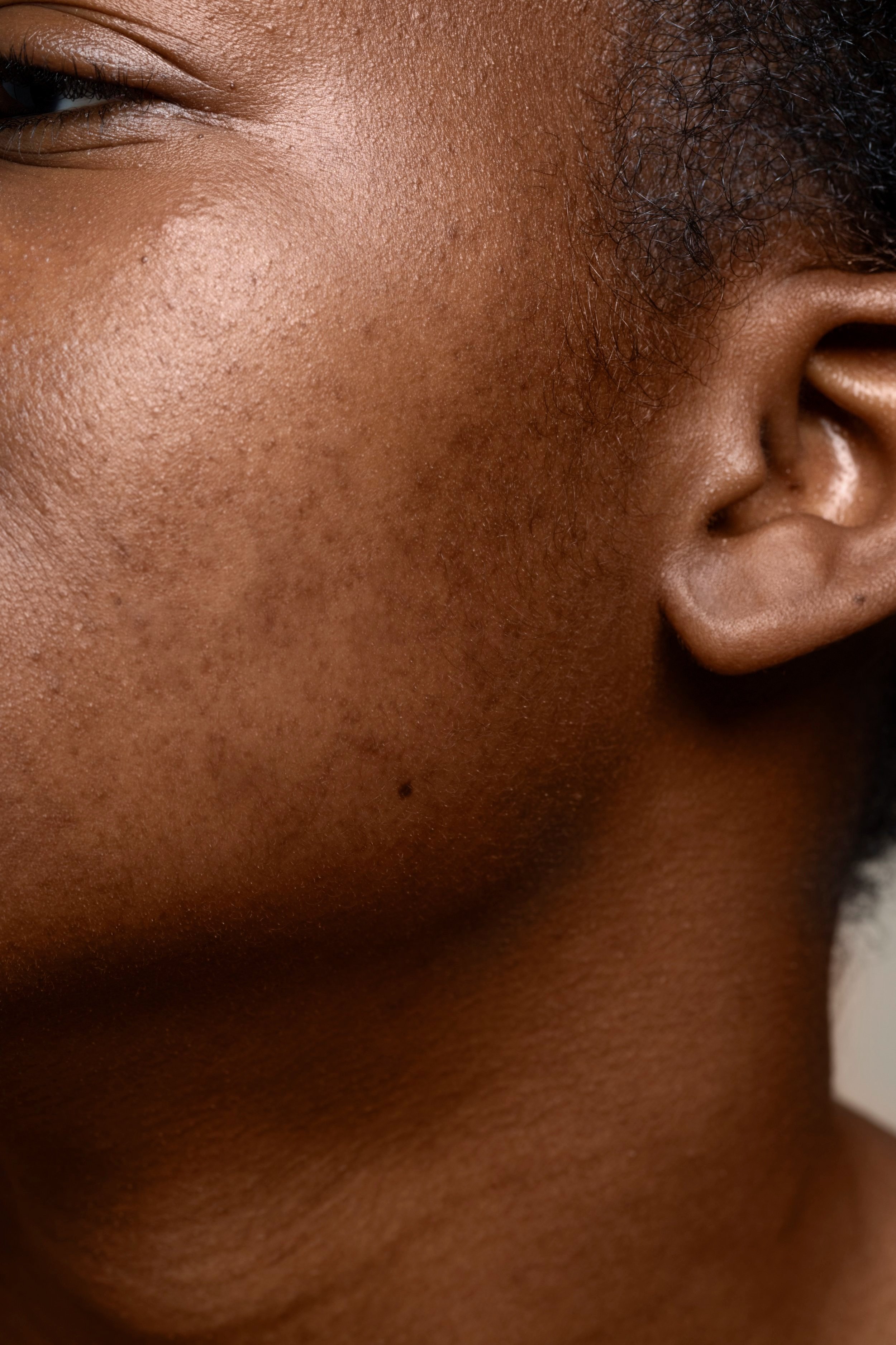 Uneven Skin Tone — SLK Beauty Lab