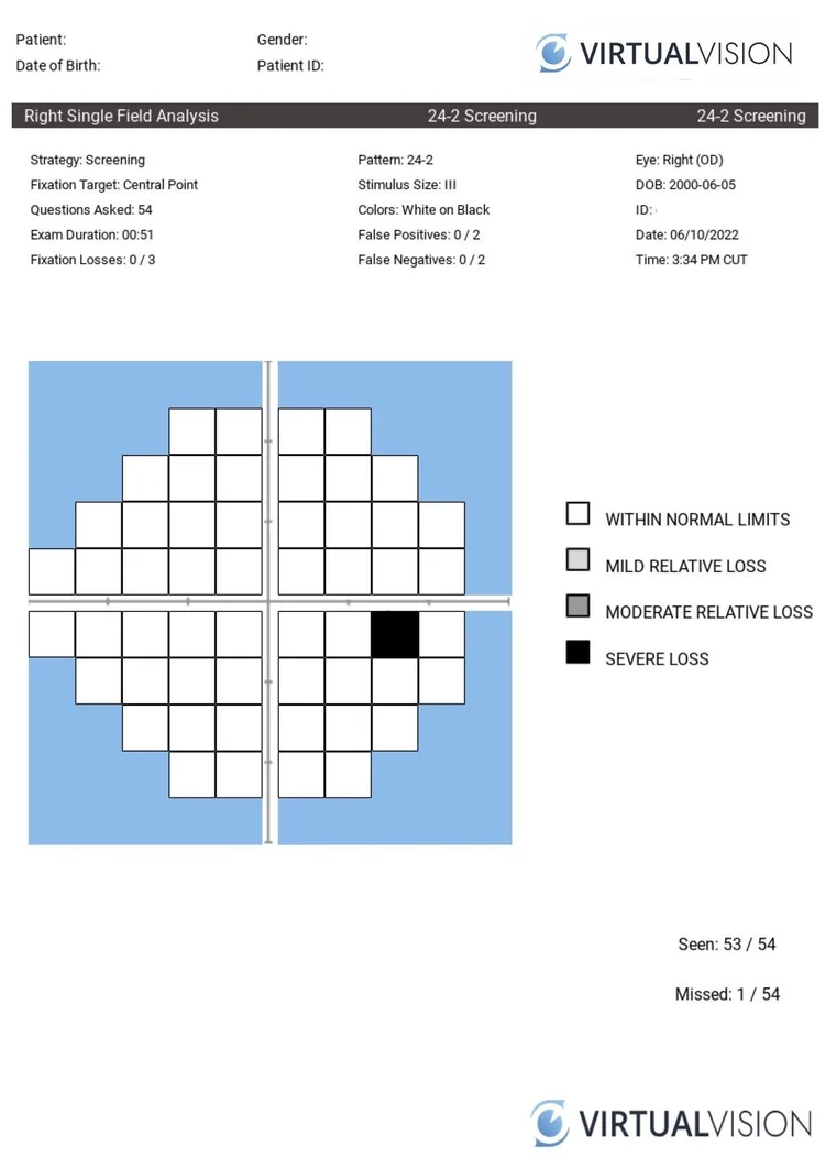 Virtual Vision Virtual Eye VR Headset Visual Field Testing — Culey ...