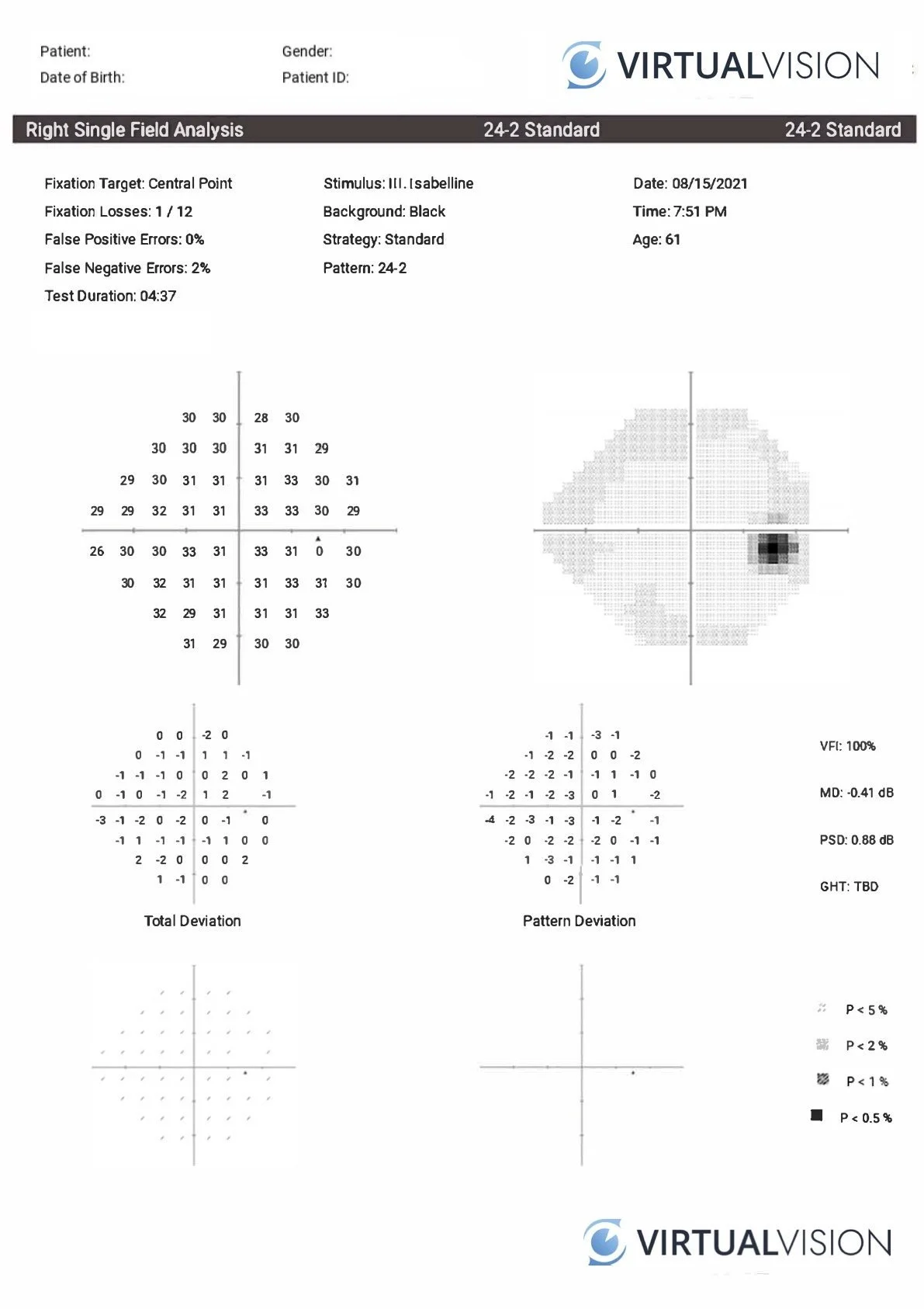 Virtual Vision Virtual Eye VR Headset Visual Field Testing — Culey ...