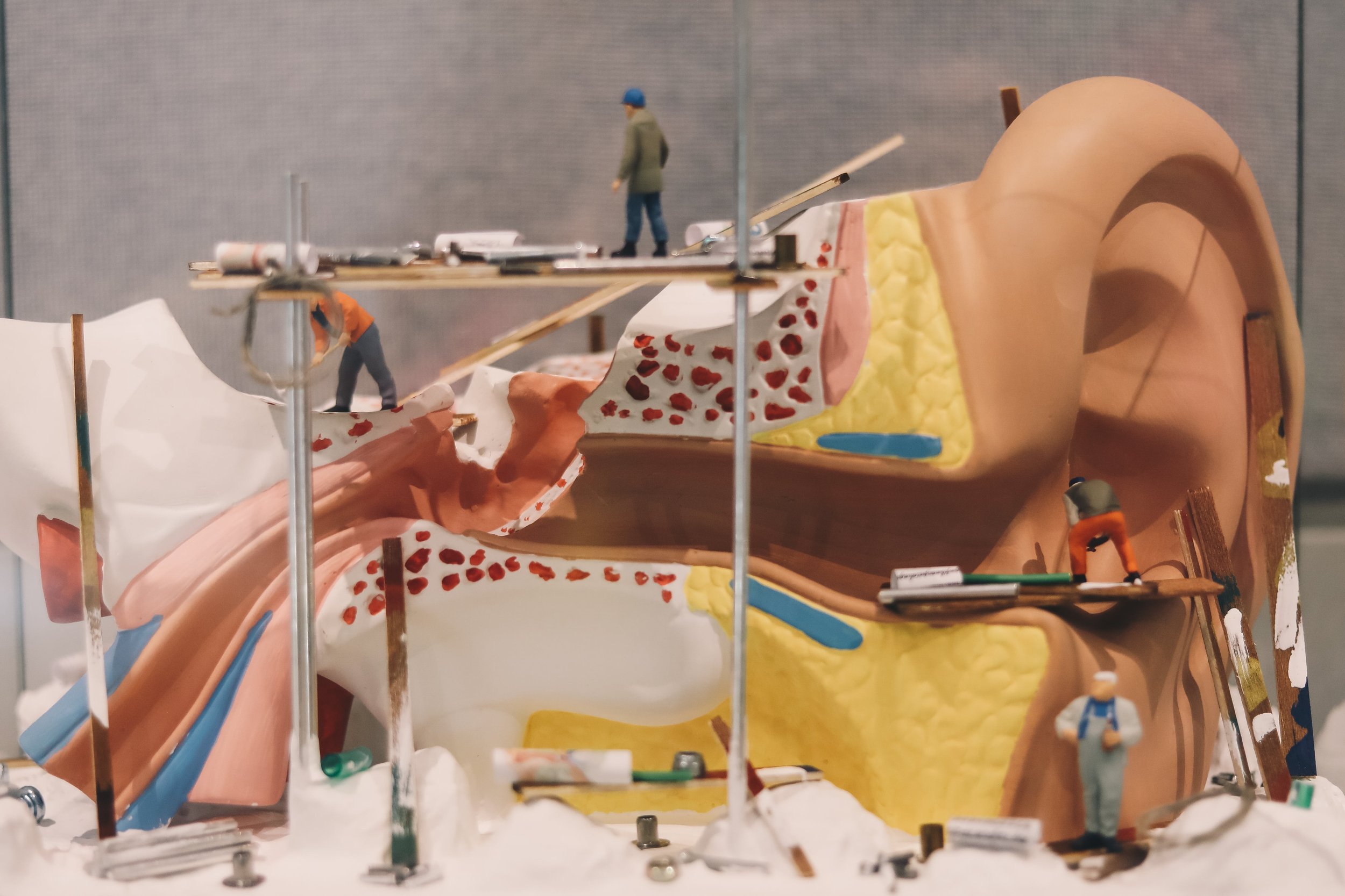 Micro-Suction vs Ear Syringing — The Well Being