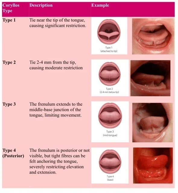 Oral ties explained: Types, symptoms and why early release matters” — Dr Carly Hupfeld