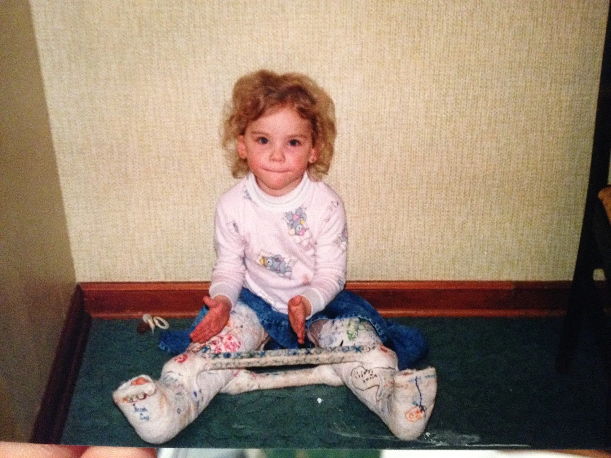 About Ollier Maffucci — Osso Foundation: Bone Health for All