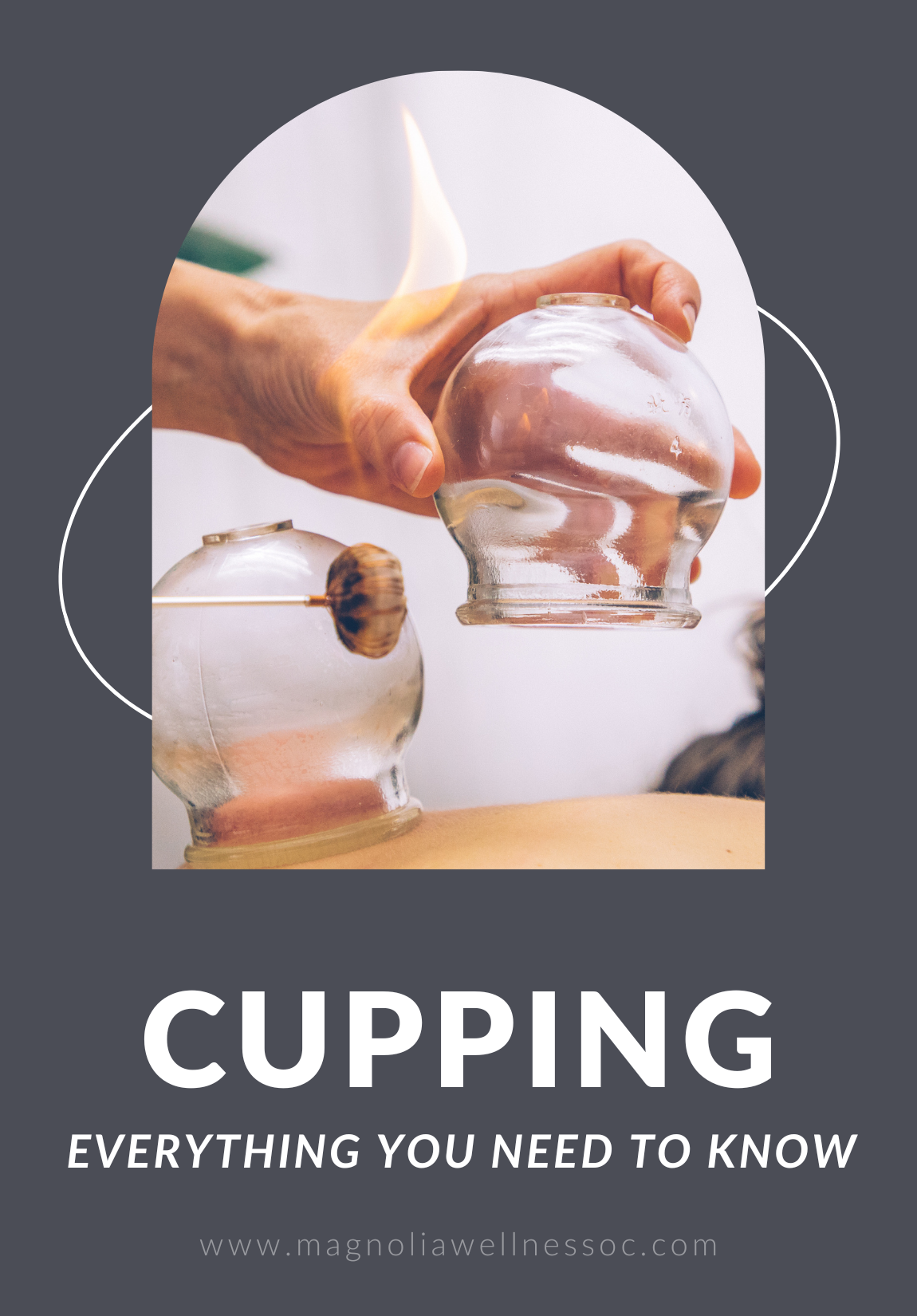 Everything You Need To Know About Cupping — Magnolia Wellness