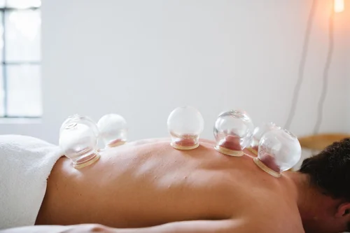 Everything You Need To Know About Cupping — Magnolia Wellness