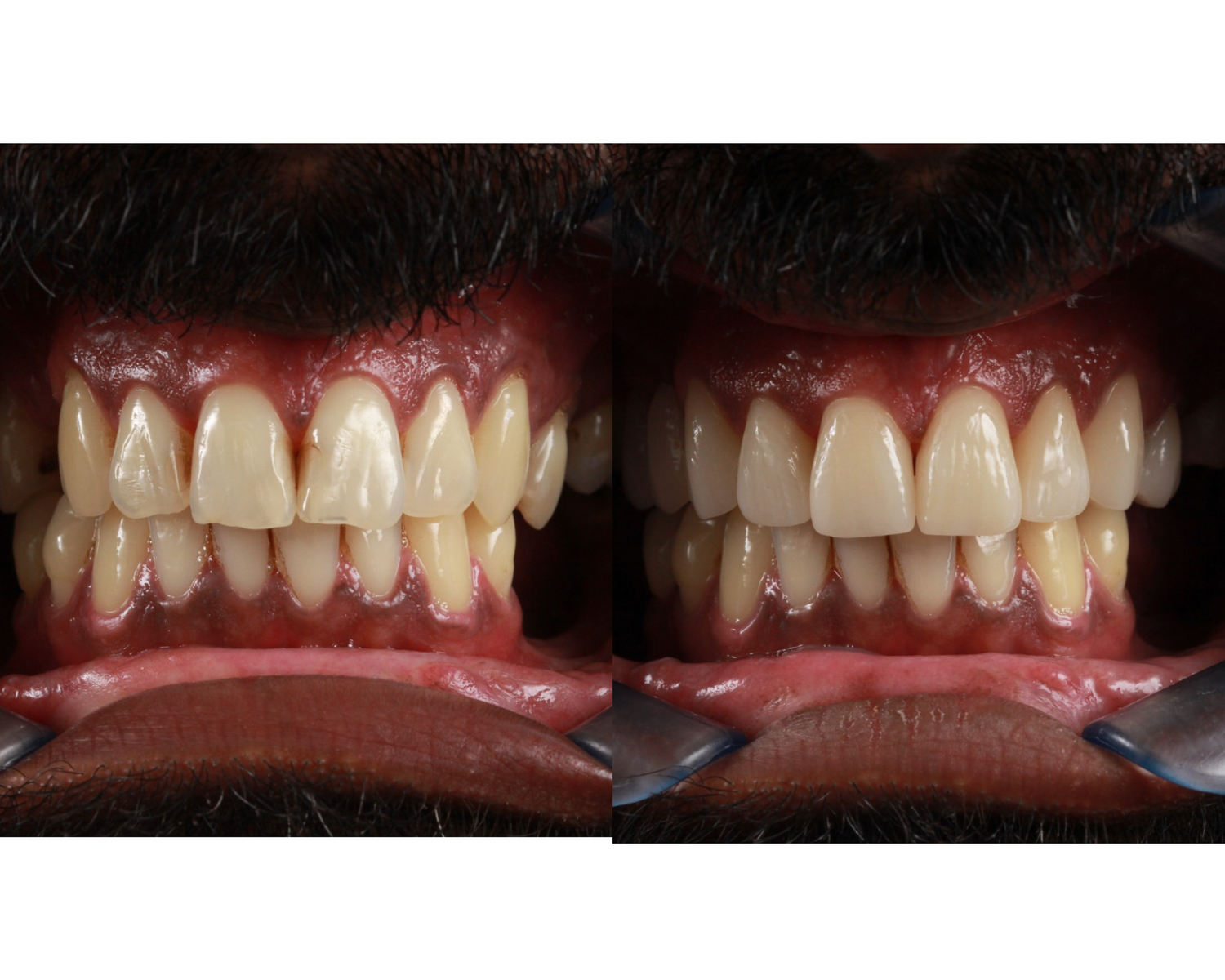 The Smile Zone | Transform Your Smile Today