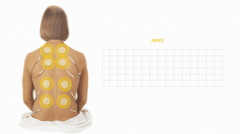 RS-4i® Plus Sequential Stimulator with Intersperse — RS Medical