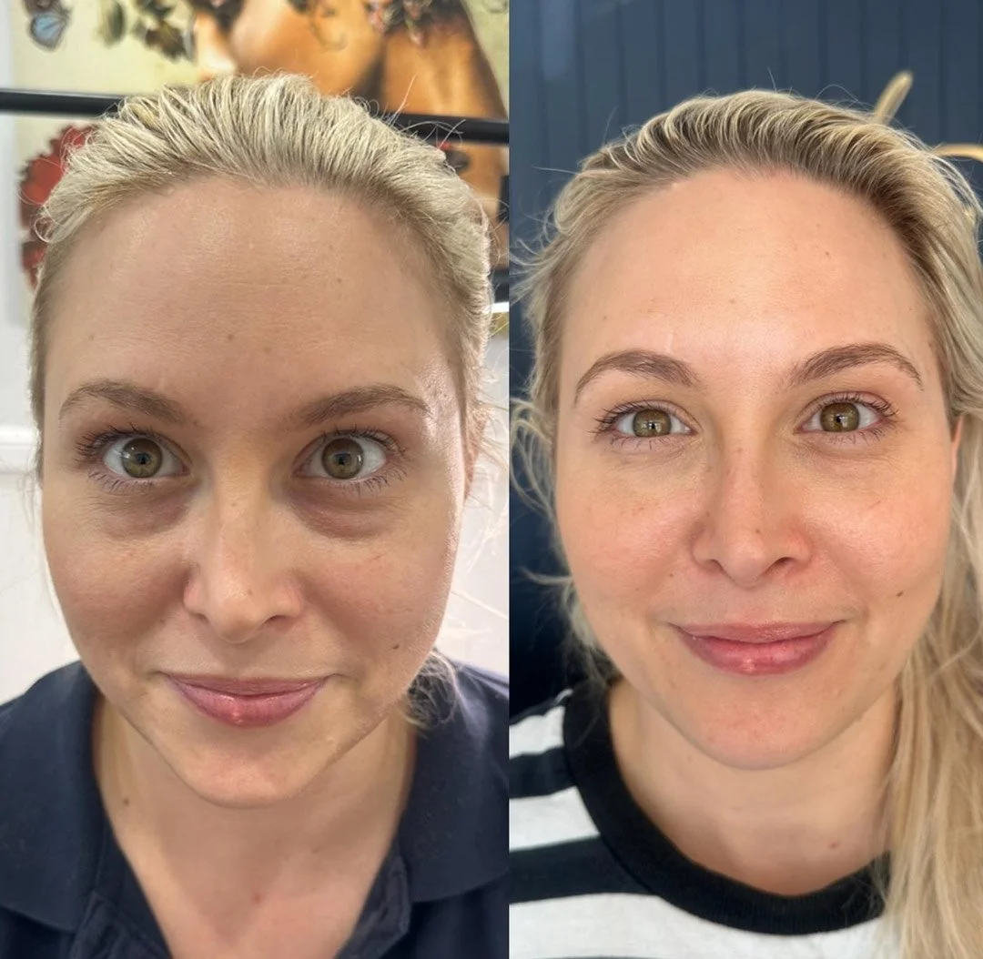 Results | Amanda Fritz Aesthetics | Cairns
