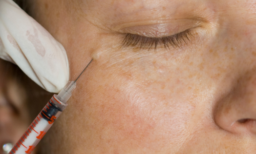 Anti-Wrinkle Injections | Achieve Youthful Radiance — Prestige Medical ...