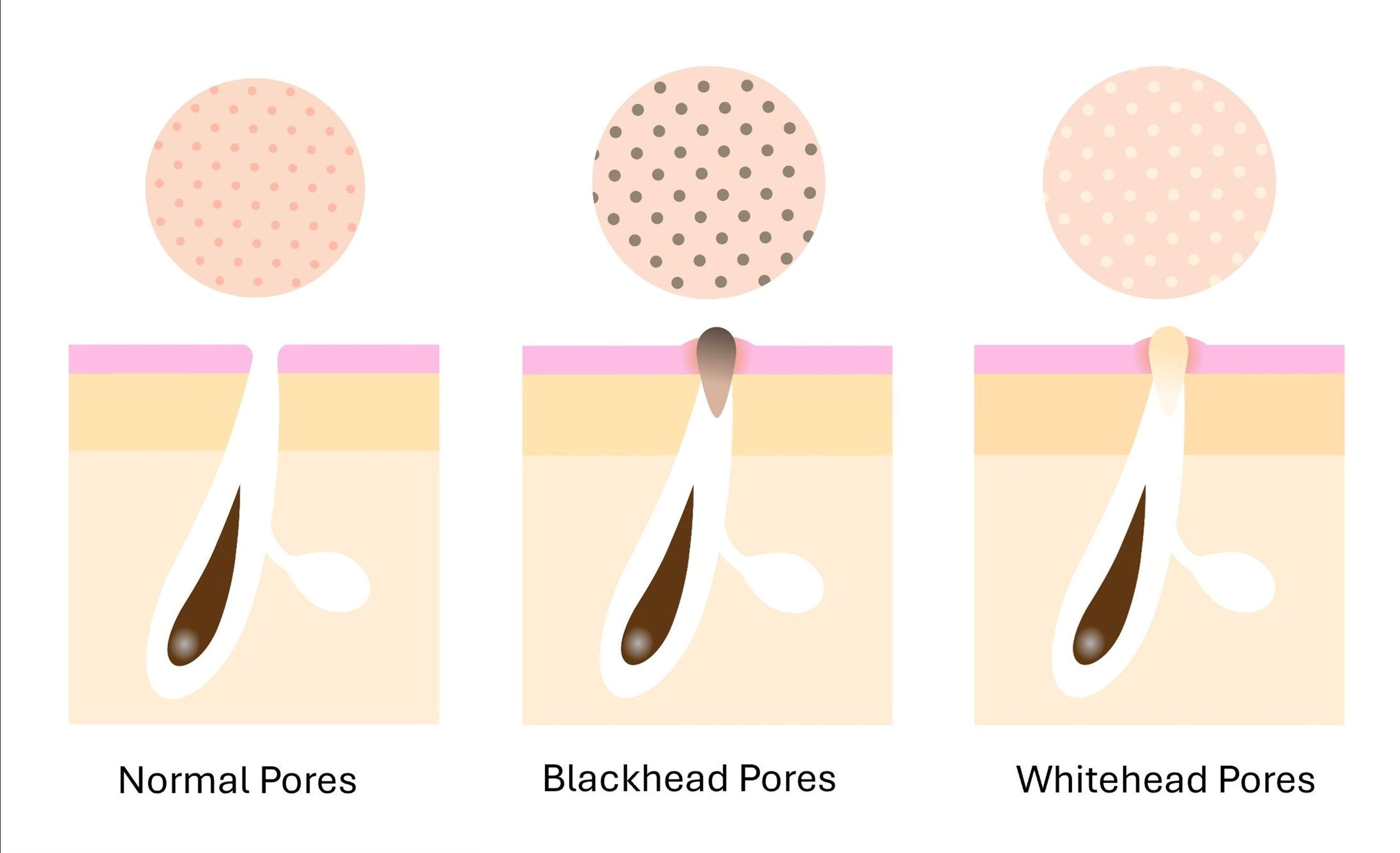 The Science of Pore Minimization: What Works & What Doesn't | The ...
