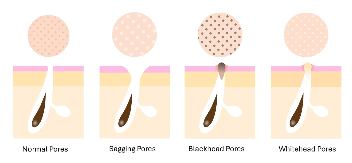 Top 5 Toners for Large Pores (Backed by Science) — The Beauty Lab