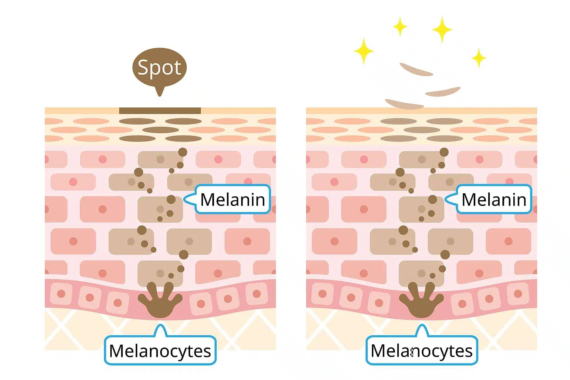 How to Fade Dark Spots Fast: Science-Backed Ingredients That Work — The ...