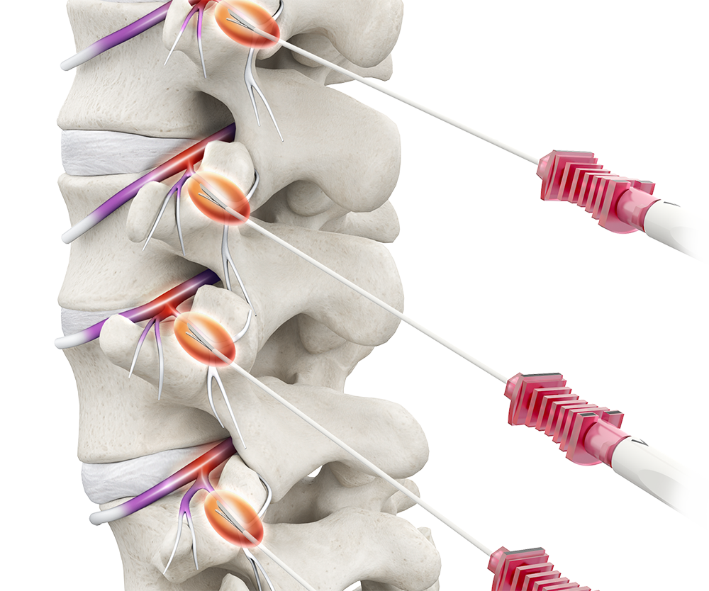 Nexus Pain Management