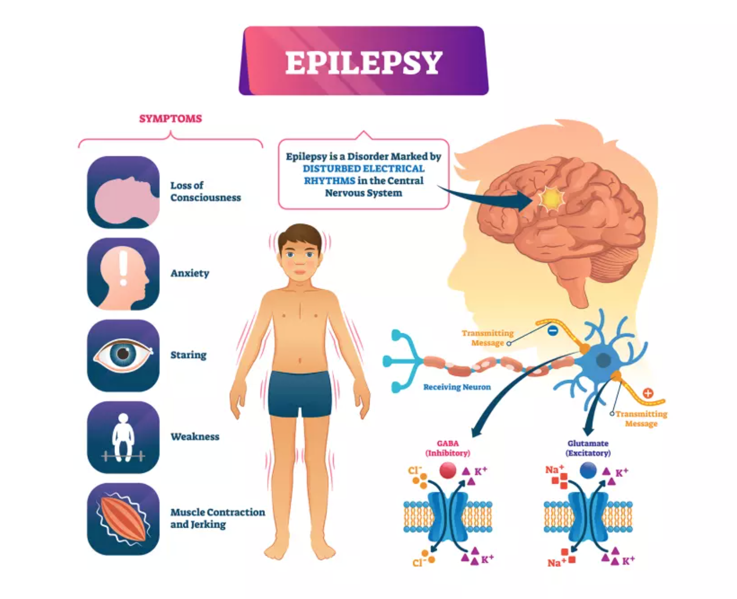 Managing Generalized Epilepsy: Treatment Strategies and Personalized ...