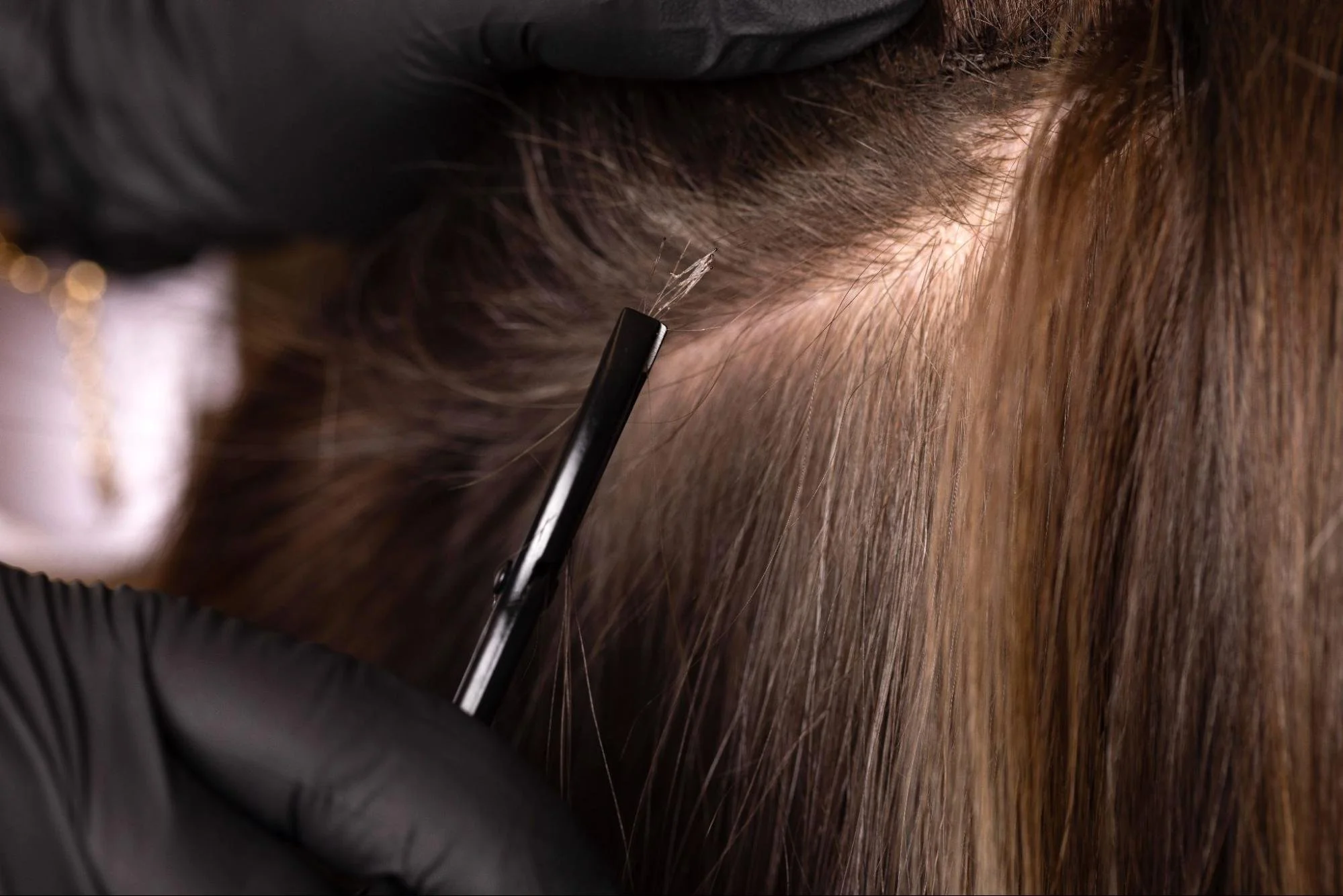 How Hair Follicle & Lab Testing Reveal the Root Causes of Hair Loss | NHLMA