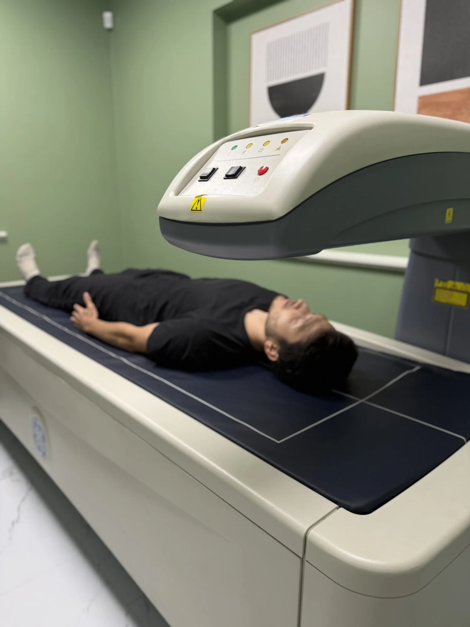 DEXA Health Vancouver - $30 DEXA Body Composition Scans