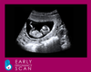 Baby Scan Leeds - All Scans For £39 Only