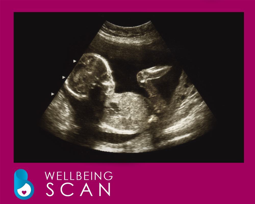Baby Scan Leeds - All Scans For £39 Only
