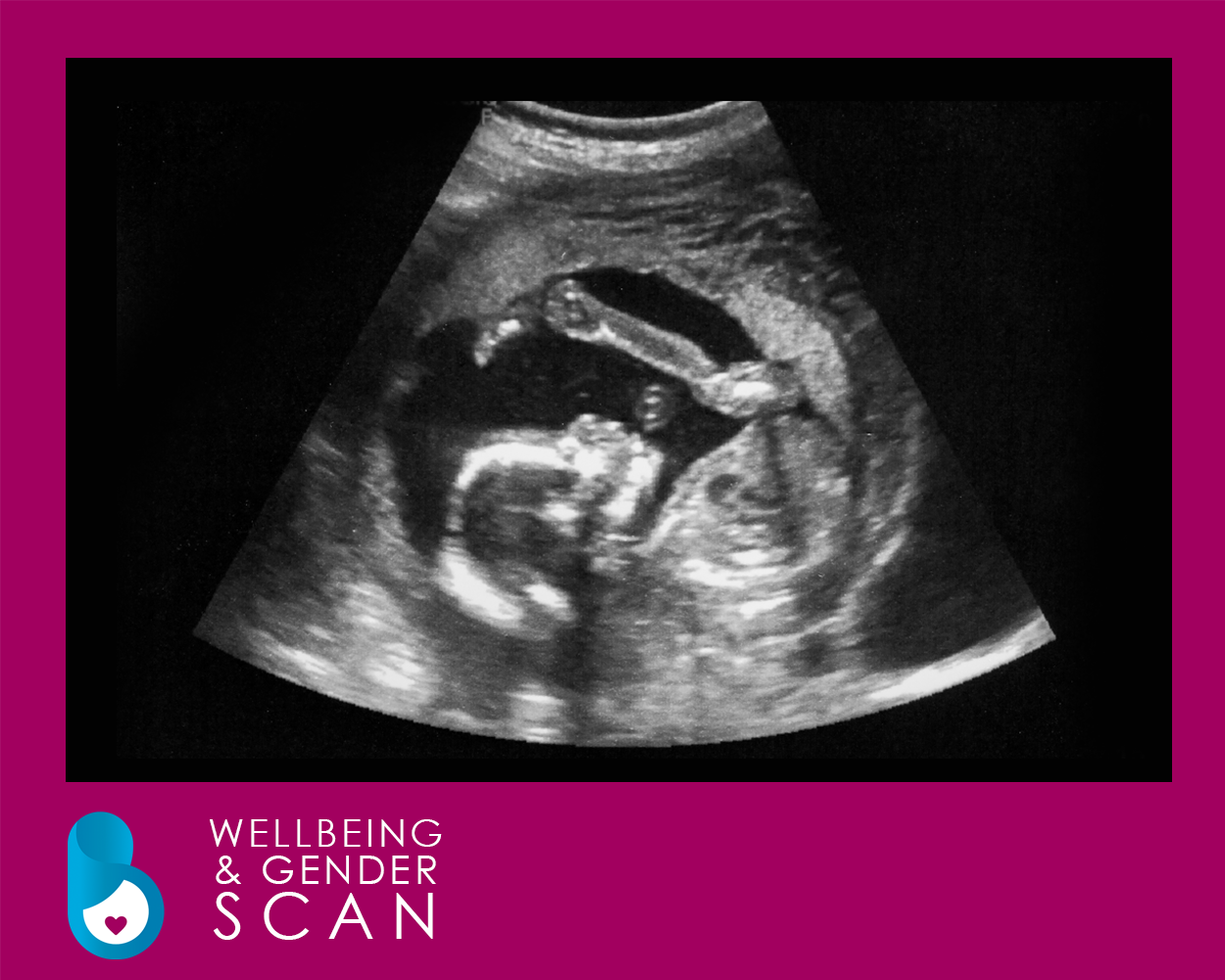 Baby Scan Leeds - All Scans For £39 Only