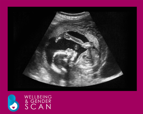Baby Scan Leeds - All Scans For £39 Only