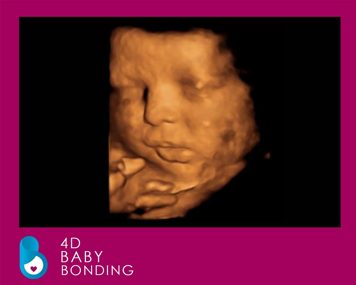 Baby Scan Leeds - All Scans For £39 Only