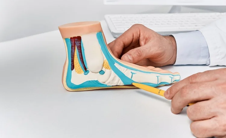 Differences Between Flat Feet and High Arches Explained | Podhills Podiatry