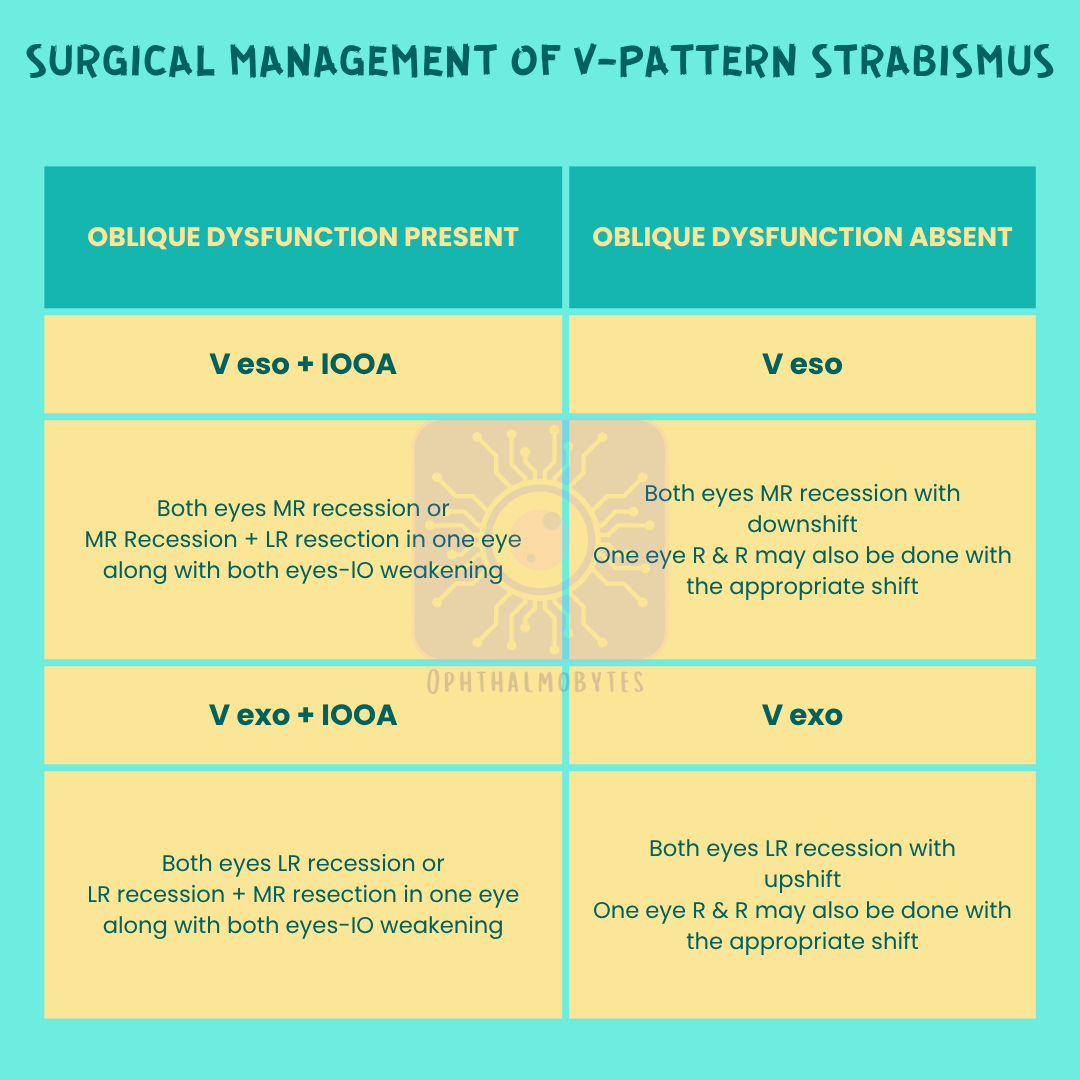V-Pattern Strabismus — Ophthalmobytes