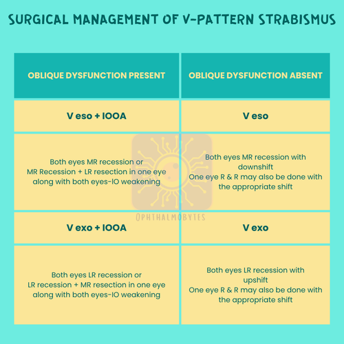 V-Pattern Strabismus — Ophthalmobytes