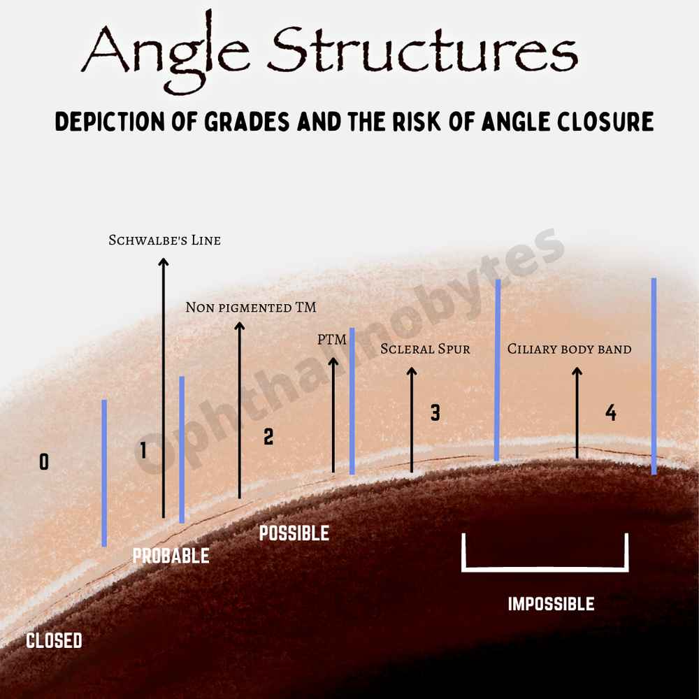Shaffer Grading - Gonioscopy — Ophthalmobytes
